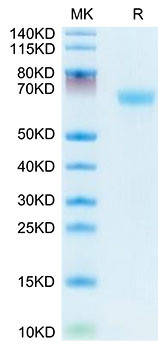 Recombinant Mouses LAMP5 Protein (RPCB1661) - Assay Genie Japan