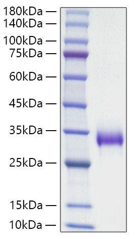Recombinant Mouse TIMP-1 Protein (RPCB1871) - Assay Genie Japan