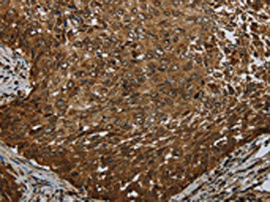 Anti-MT-ND3 抗体 (PACO20050) | IHC