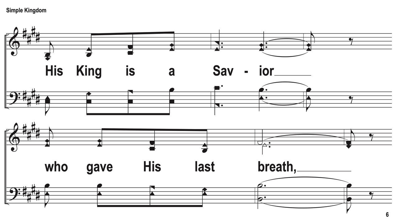 Simple Kingdom (Song Slides) - fearless4You.com