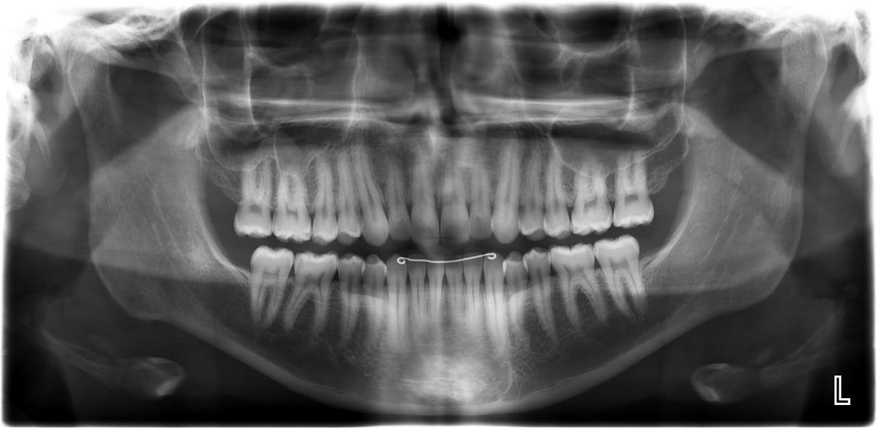 Planmeca ProMax 3D Mid Pano + Cone Beam | Renew Digital