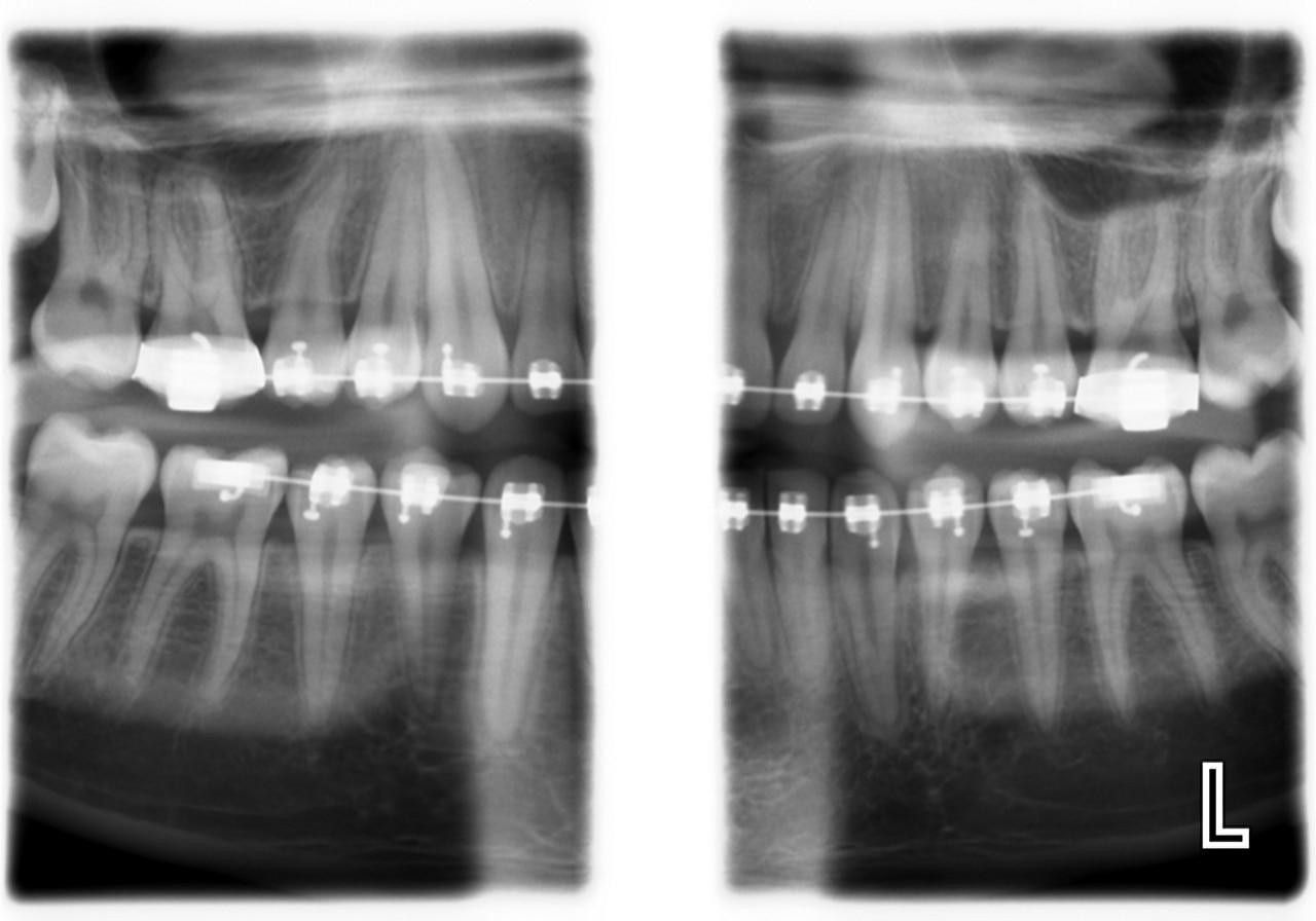 Buy Planmeca Promax 3D Mid Panorex + Cone Beam Online | Renew Digital