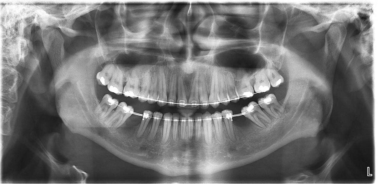 Buy Planmeca Promax 3D Mid Panorex + Cone Beam Online | Renew Digital