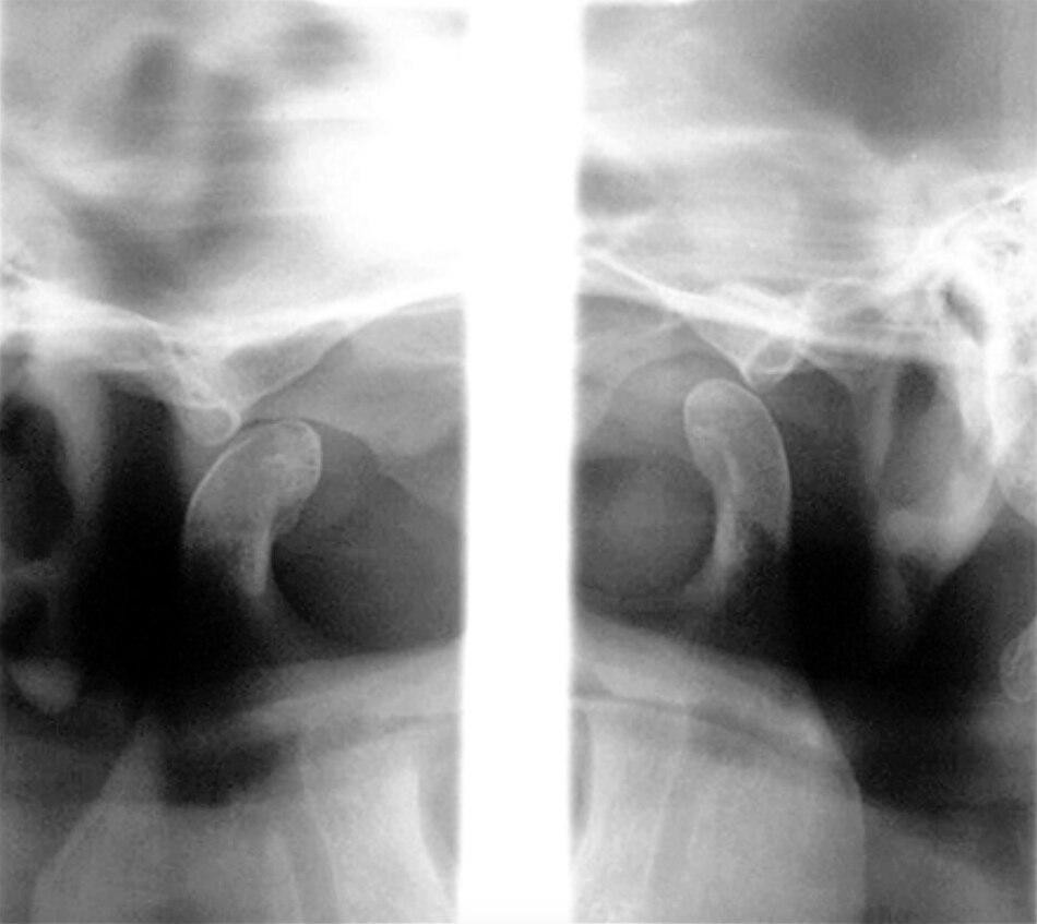 Carestream CS 8100 3D Panorex + Cone Beam | Renew Digital