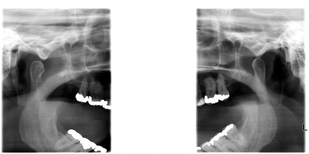 DEXIS (Formerly KaVo) OP 3D Pro Panorex + Cone Beam | Renew Digital