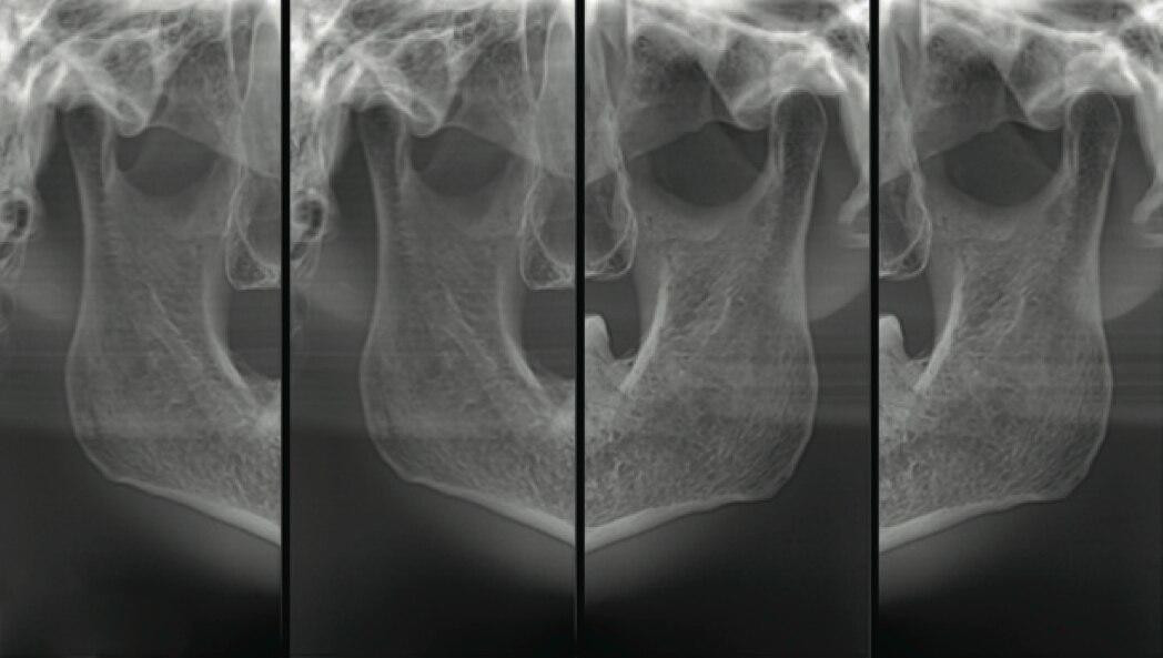 Vatech PaX-i Panoramic X-Ray, Dental X-Ray Machine Online