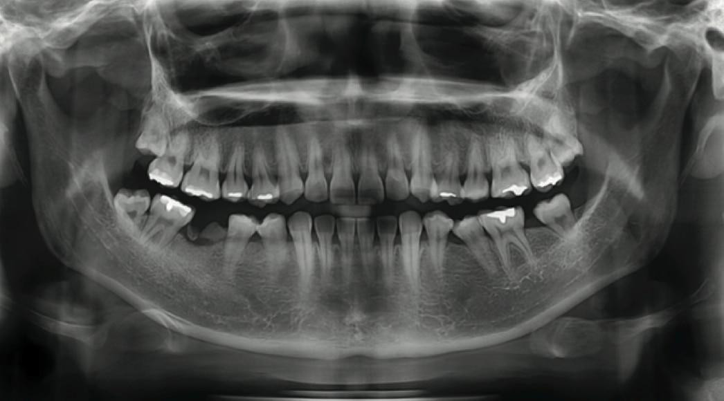 Vatech PaX-i Panoramic X-Ray, Dental X-Ray Machine Online