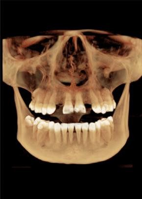 Buy DEXIS OP 3D Panorex Cone Beam Online | Renew Digital