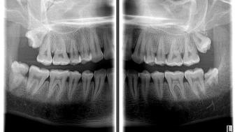 Buy DEXIS OP 3D Panorex Cone Beam Online | Renew Digital