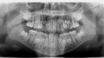Buy DEXIS OP 3D Panorex Cone Beam Online | Renew Digital