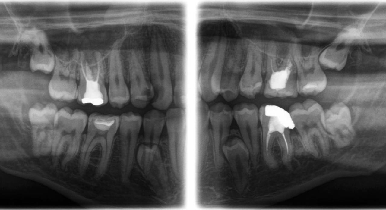 Sirona Orthophos SL 3D Panorex + Cone Beam For Sale | Renew Digital