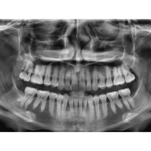 Vatech Pax-I3D Smart Plus Panorex + Cone Beam For Sale | Renew Digital