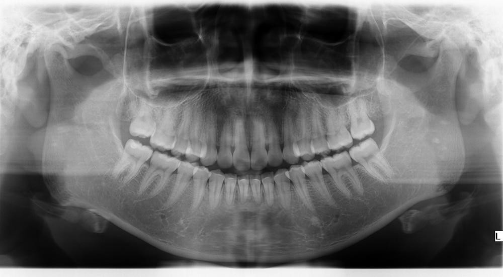 DEXIS OP 3D Pro Panorex + Cone Beam For Sale | Renew Digital