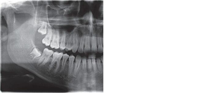 Sirona Orthophos XG 3D Panorex + CEPH + Cone Beam | Renew Digital