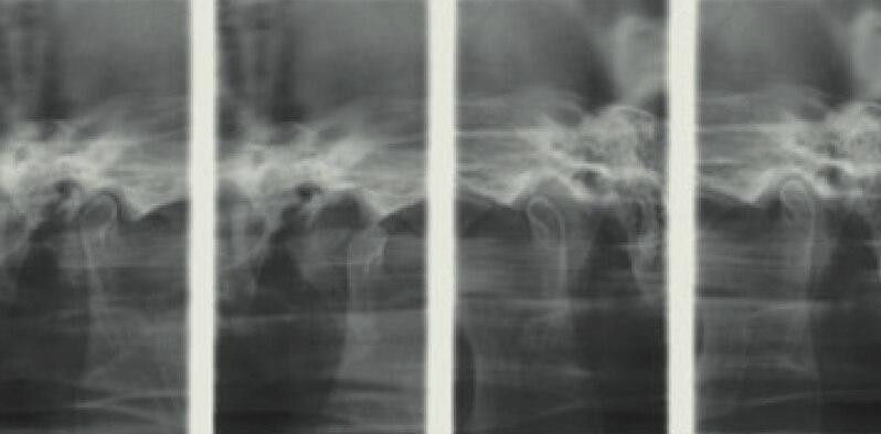 Sirona Orthophos XG 3D Panorex + CEPH + Cone Beam | Renew Digital