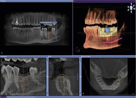 Sirona Orthophos XG 3D Panoramic + Cephalometric + CBCT | Renew Digital