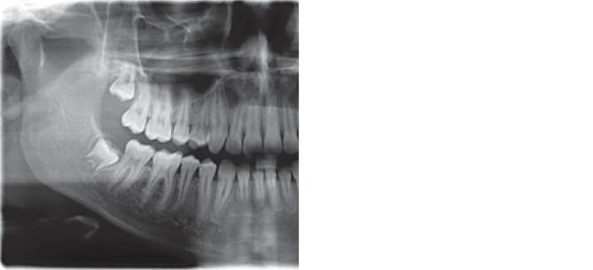 Buy Sirona Orthophos Xg 3d Ready Panorex + Ceph Online | Renew Digital