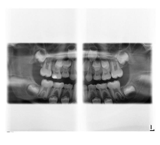 Sirona Orthophos XG 3D Panoramic + Cone Beam X-ray Machine | Renew Digital