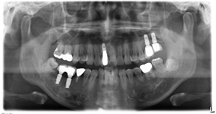 Sirona Orthophos XG 3D Panoramic + Cone Beam X-ray Machine | Renew Digital