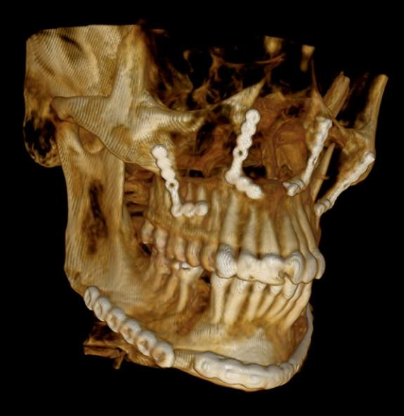 Carestream CS 9300 Premium Panorex + Cone Beam For Sale | Renew Digital