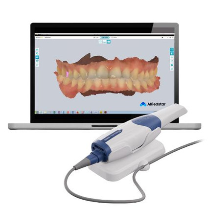 AlliedStar AS-260 Intraoral Scanner & Laptop Bundle | Renew Digital