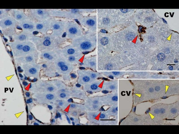 LRAT (Lecithin Retinol Acyltransferase) (168) Anti-Mouse Rabbit IgG ...