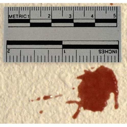 Forensics Source Adhesive Scales