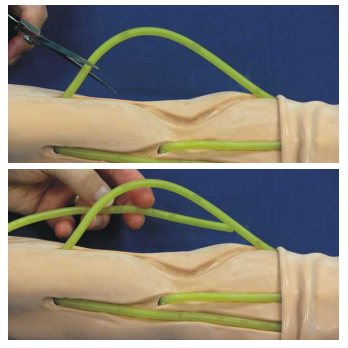 Simulaids IV Training Arm or Hand Replacement Veins