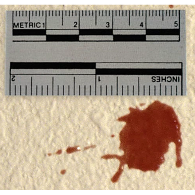Forensics Source Adhesive Scales