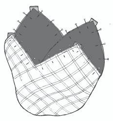 Mondo Bag