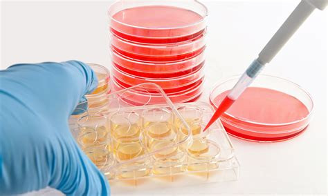KATO III Cells - Antibody Research Corporation