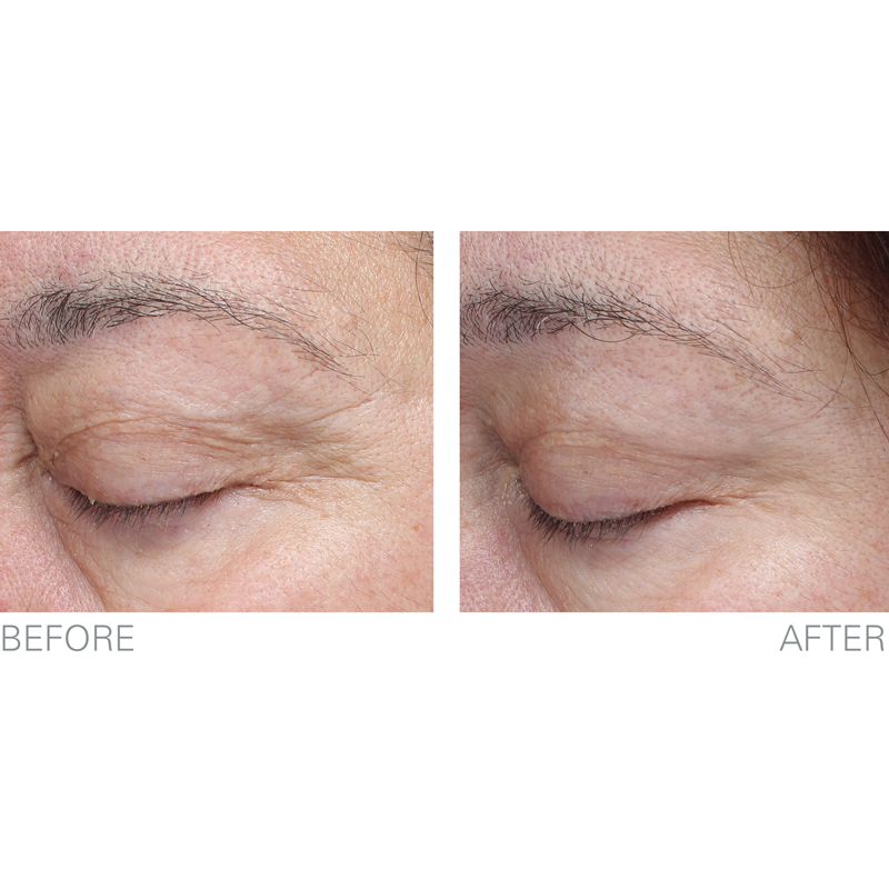 Silver Radiance 7-Day Youth Complex, Anti-Aging Skin Care Serum reduces ...