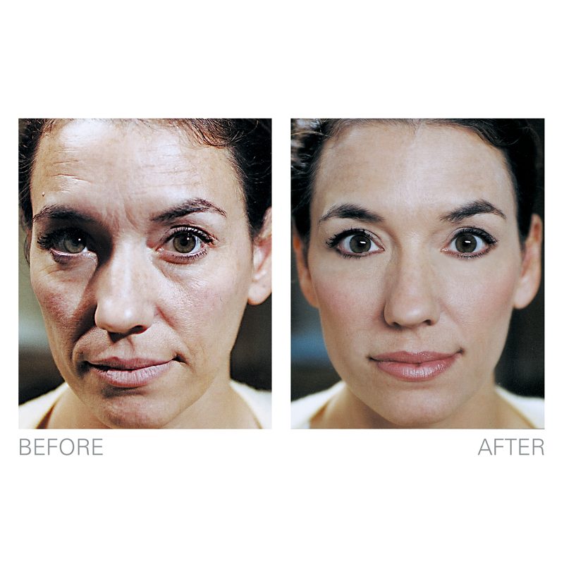 Sta-Tight Lifting Serum reduces the appearance of "expression lines ...