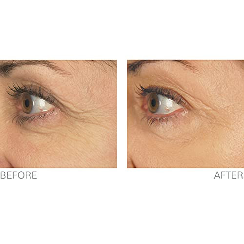 Stem Cell Therapy INSTANT hides wrinkles instantly while it uses your ...