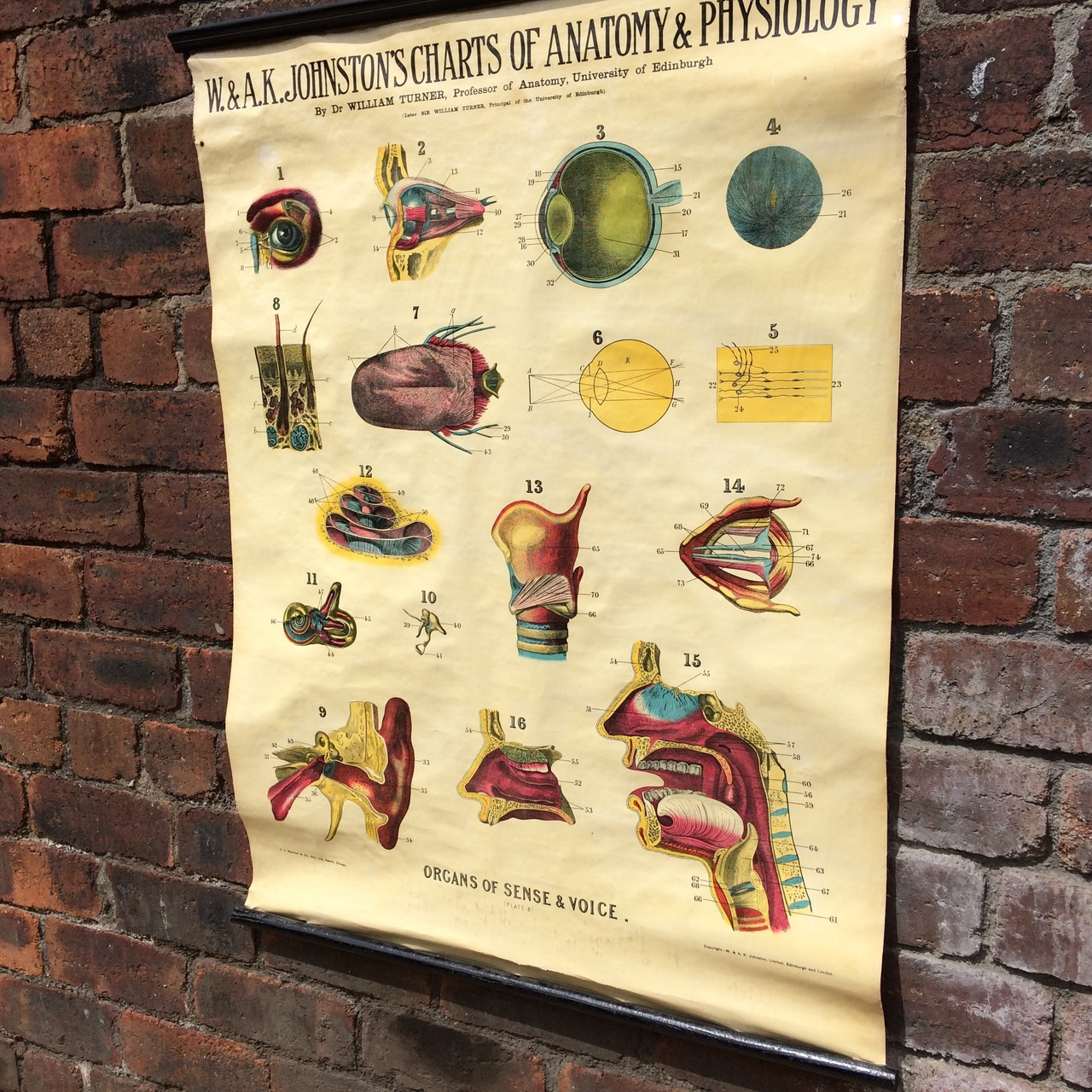 * SOLD * Vintage fabric backed Medical poster, early 20th Century ...