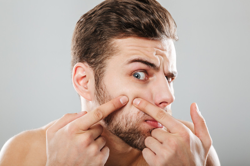 8 Easy Tricks To Keep Beard Pimples at Bay - NATURELOVA