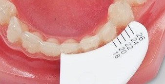 Extend LTR Long Term Retainer