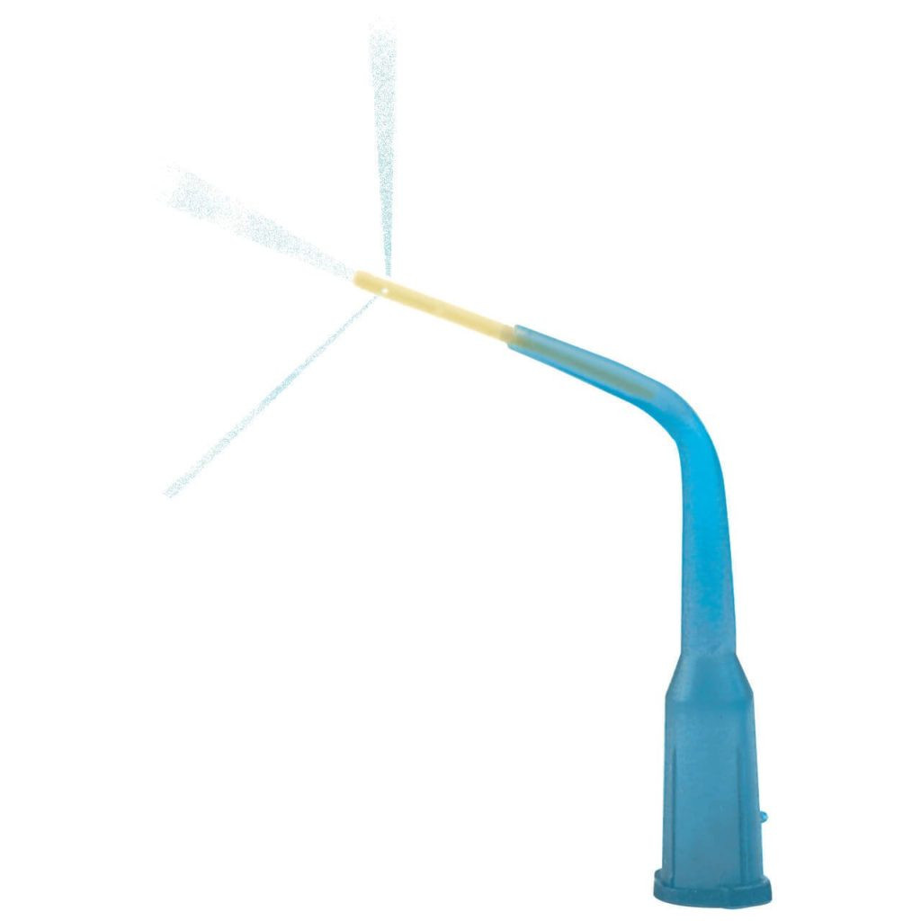 Pocket-Probe Irrigating Needle Tips.
