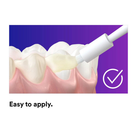 Vanish 5% Sodium Fluoride Varnish with Tri-Calc