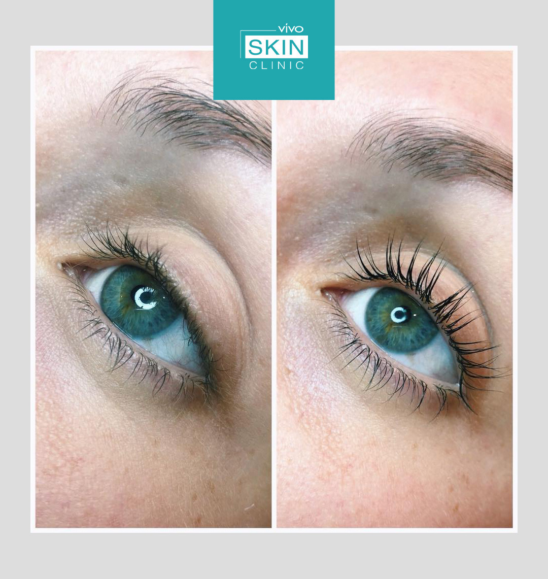 Book A Lash Lift & Tint Today | Vivo Hair & Skin Clinic