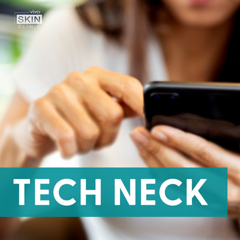 TECH NECK: What It Is And How To Prevent - Vivo Hair Salon and Skin Clinic