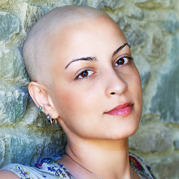 Is Hair Loss a Symptom of Cancer? - Lipogaine: Your Trusted Solution ...