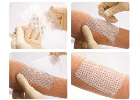 Silflex Silicone Contact Layer Dressing - MedicalDressings
