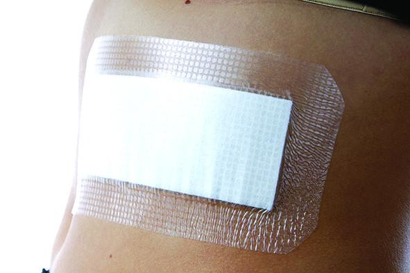 OPSITE Post-Op Breathable Adhesive dressing (Waterproof)