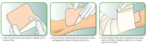 Lyofoam Max Foam Dressing - MedicalDressings