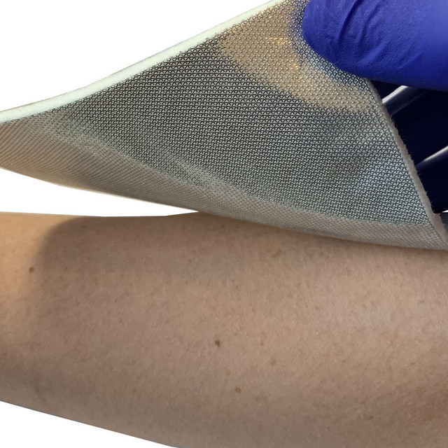 Non-Adhesive Dressings