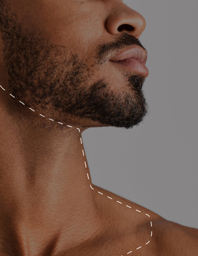 Laser Hair Removal Neck (Front or Back) | Laser Clinics United Kingdom