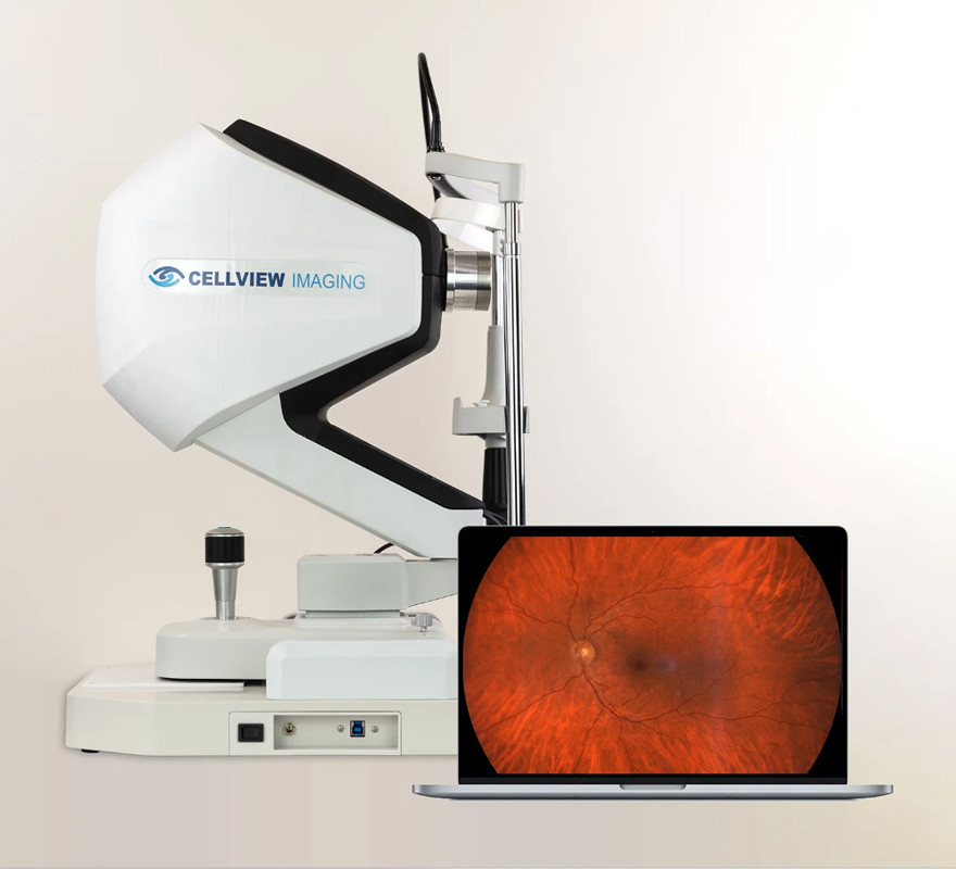 Cellview Wri 1 Retinal Imager