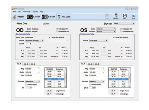 Portable A-Scan 6000, Scanmate Portable A-Scan