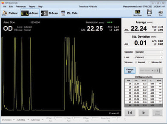 Portable A-Scan 6000, Scanmate Portable A-Scan